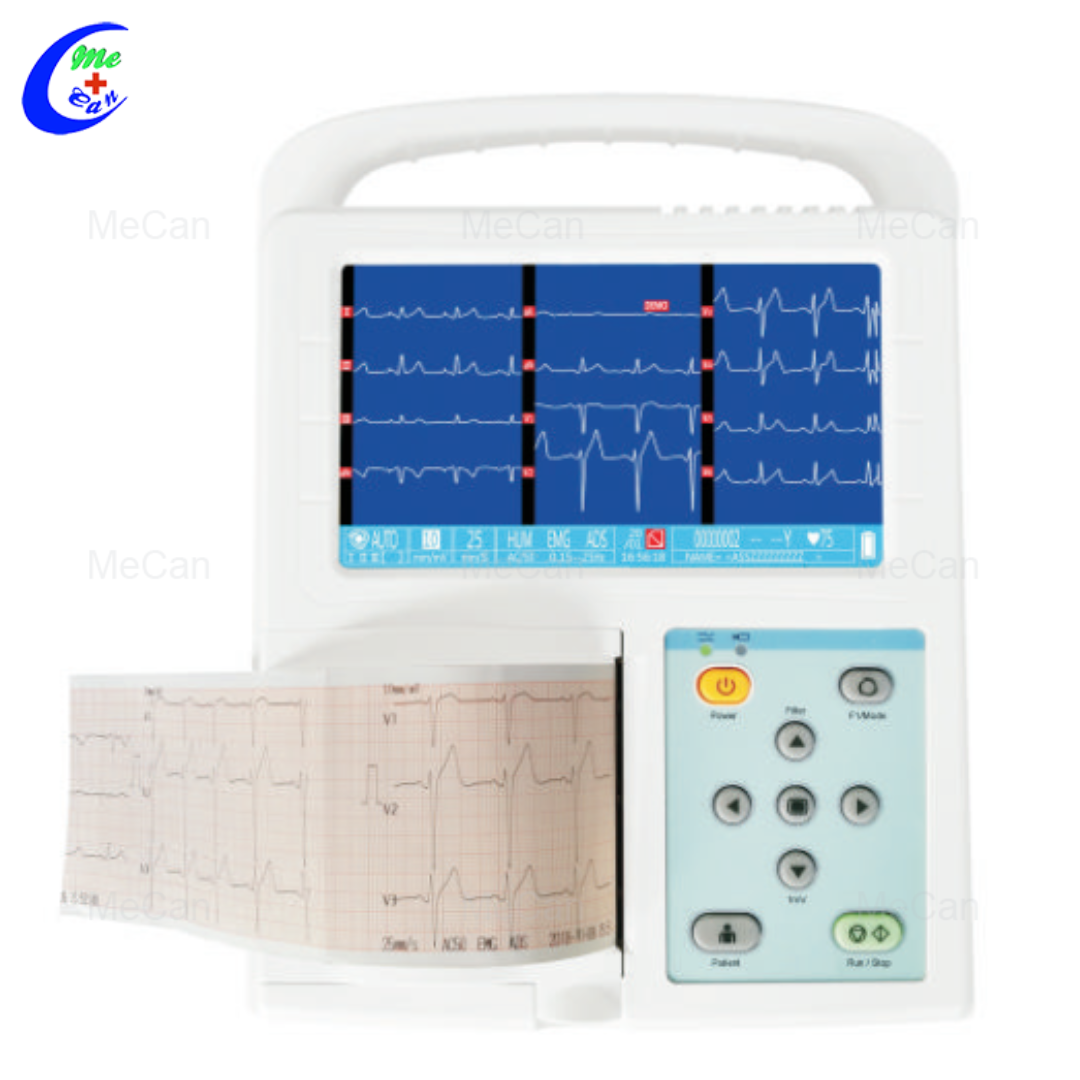 Resting ECG: Precise Heart Health Diagnosis & Monitoring