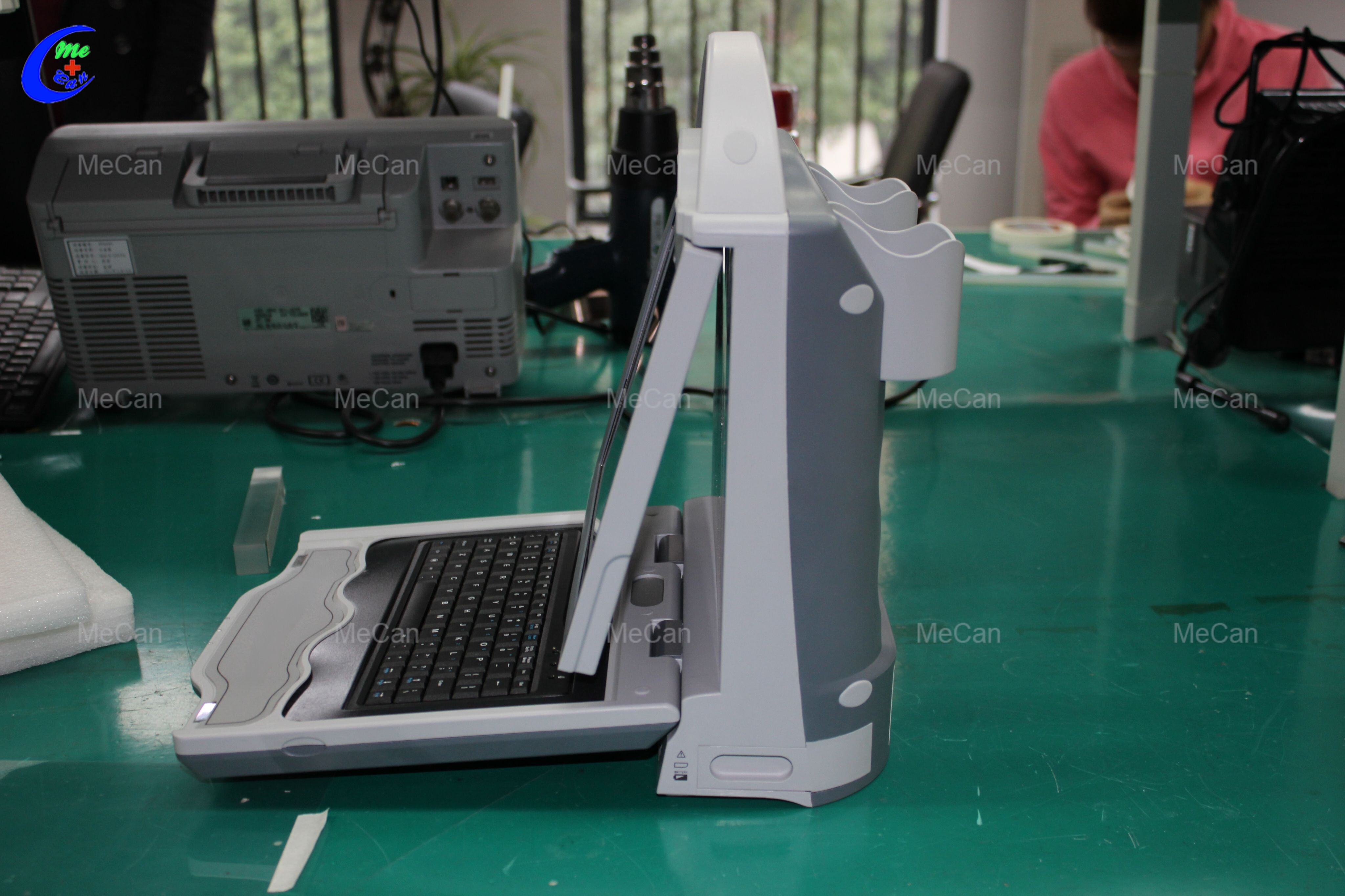 Automatic High Effective Ultrasound Bone Densitometer from China ...